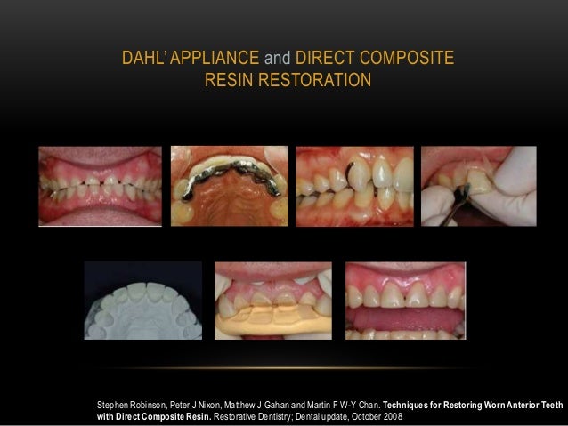 Diagnosis and treatment of choice in restoring vertical dimension
