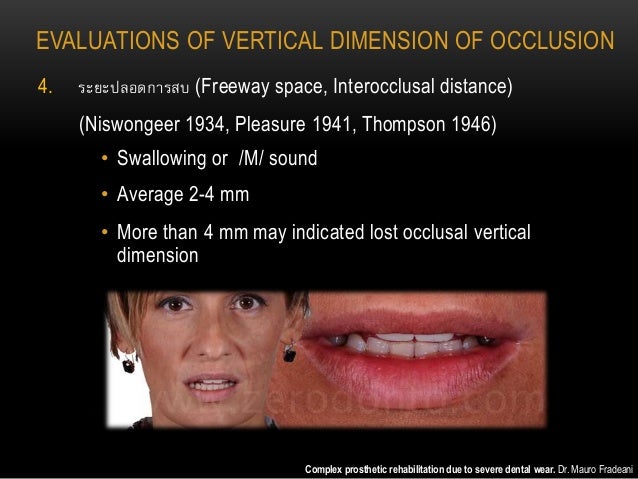 Diagnosis and treatment of choice in restoring vertical dimension