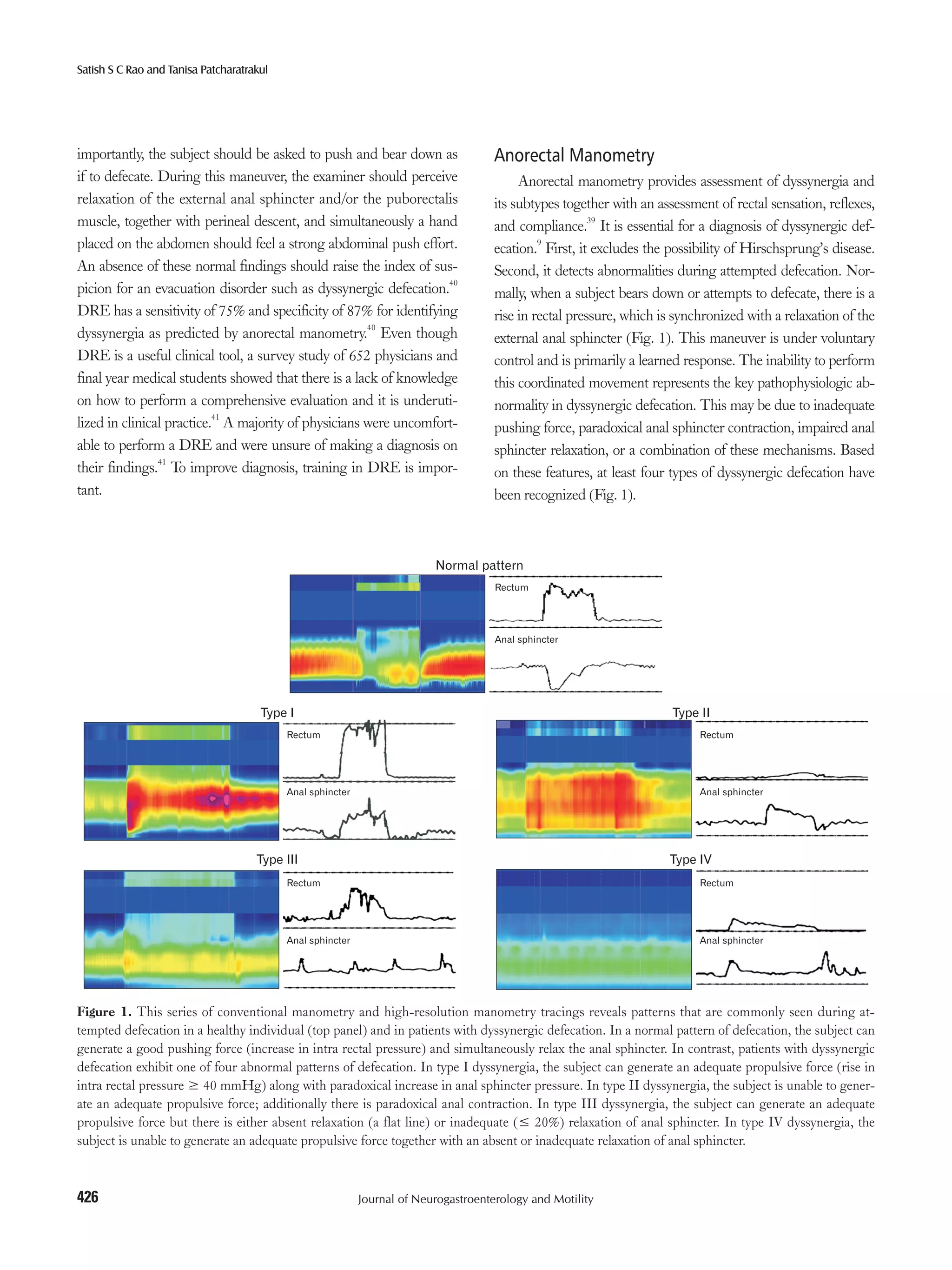 Diagnosis and treatment of Dyssynergic Defecation (Rao) | PDF
