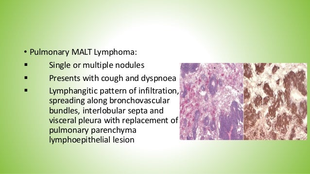 Diagnosis and treatment of gi malt lymphoma