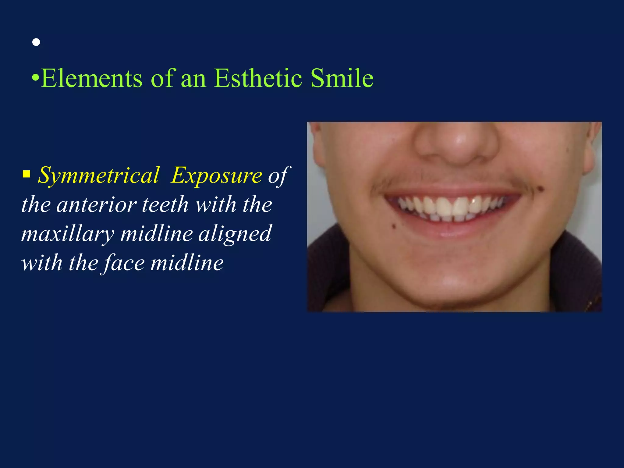 Diagnosis and treatment of gummy smile | PDF