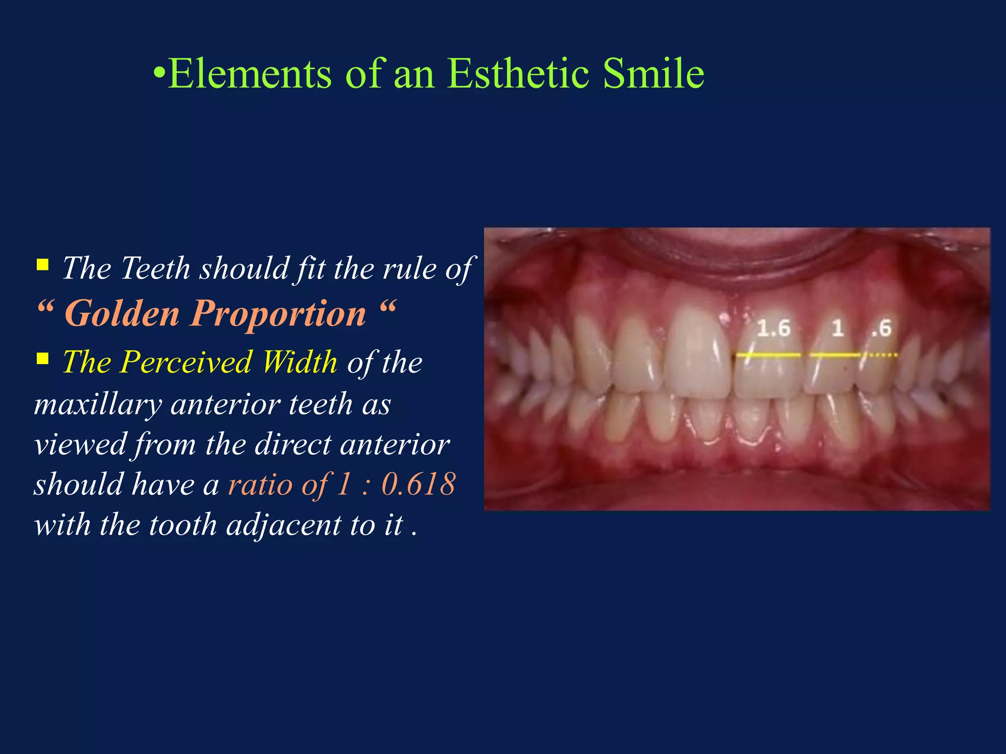 Diagnosis and treatment of gummy smile | PDF