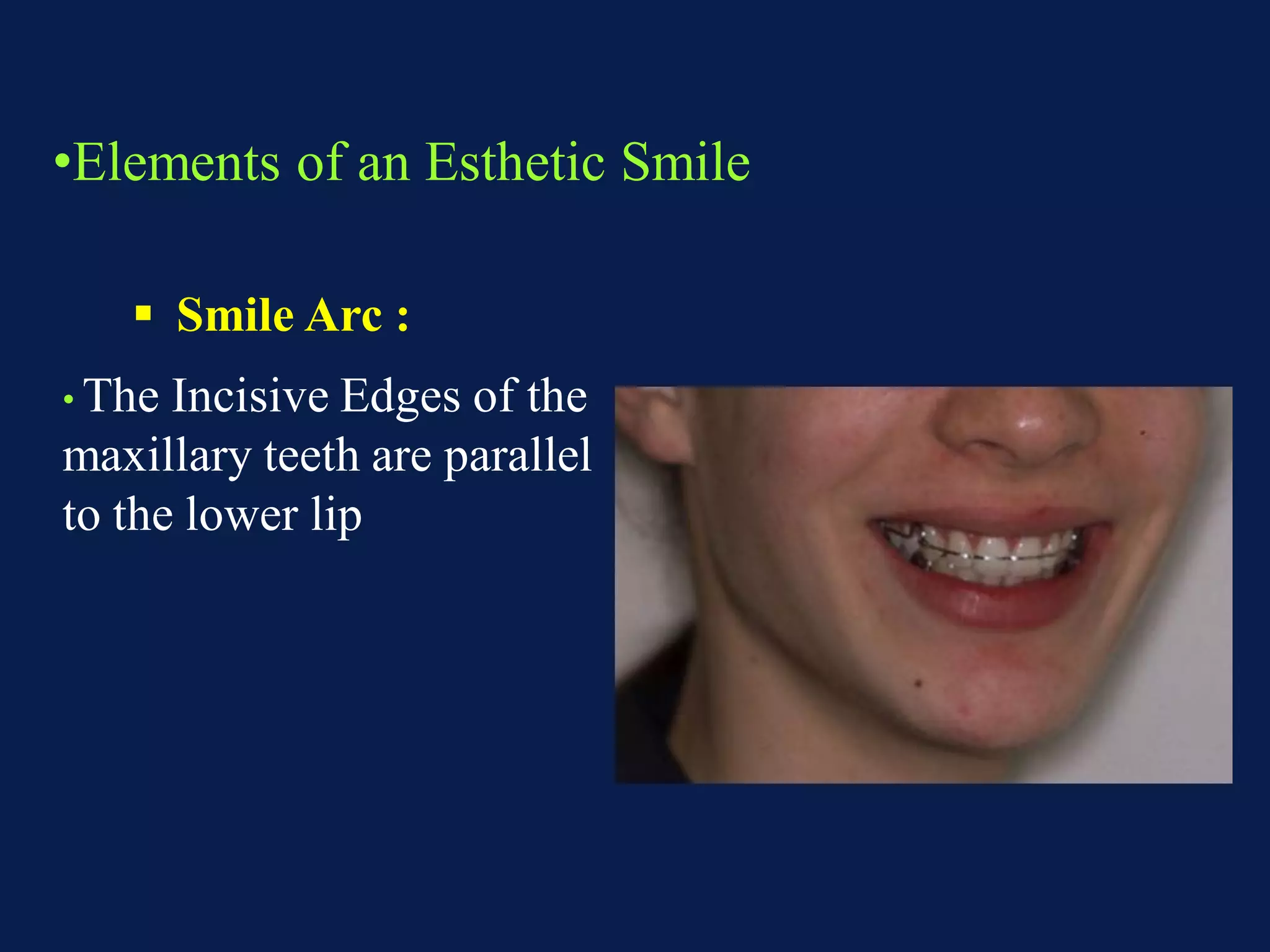 Diagnosis and treatment of gummy smile | PDF