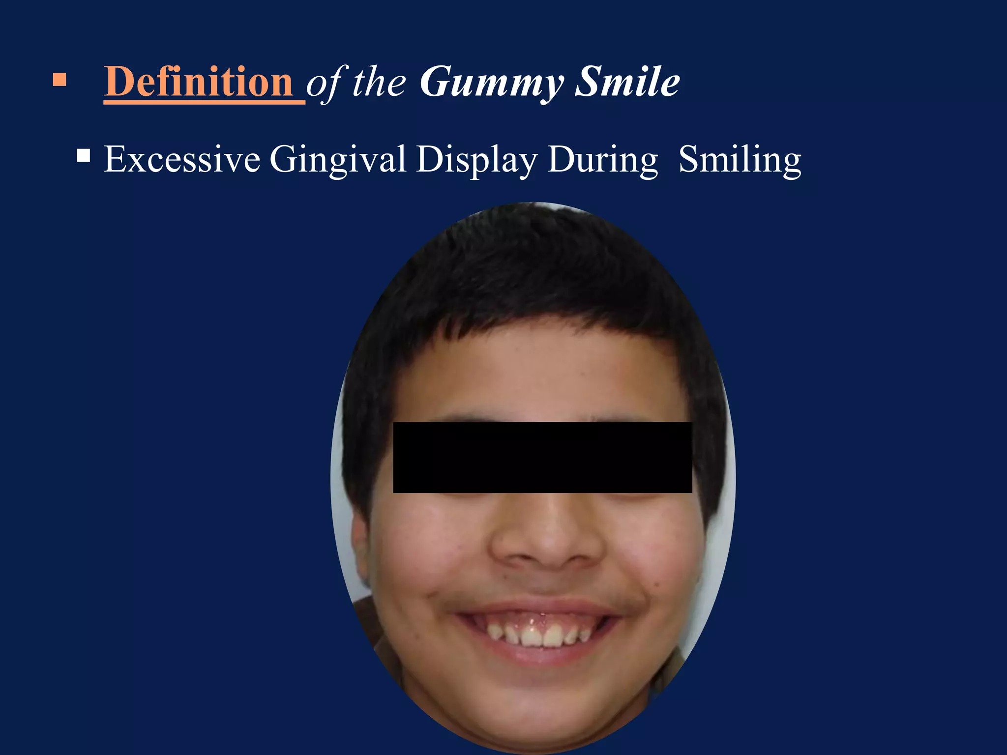 Diagnosis and treatment of gummy smile | PDF