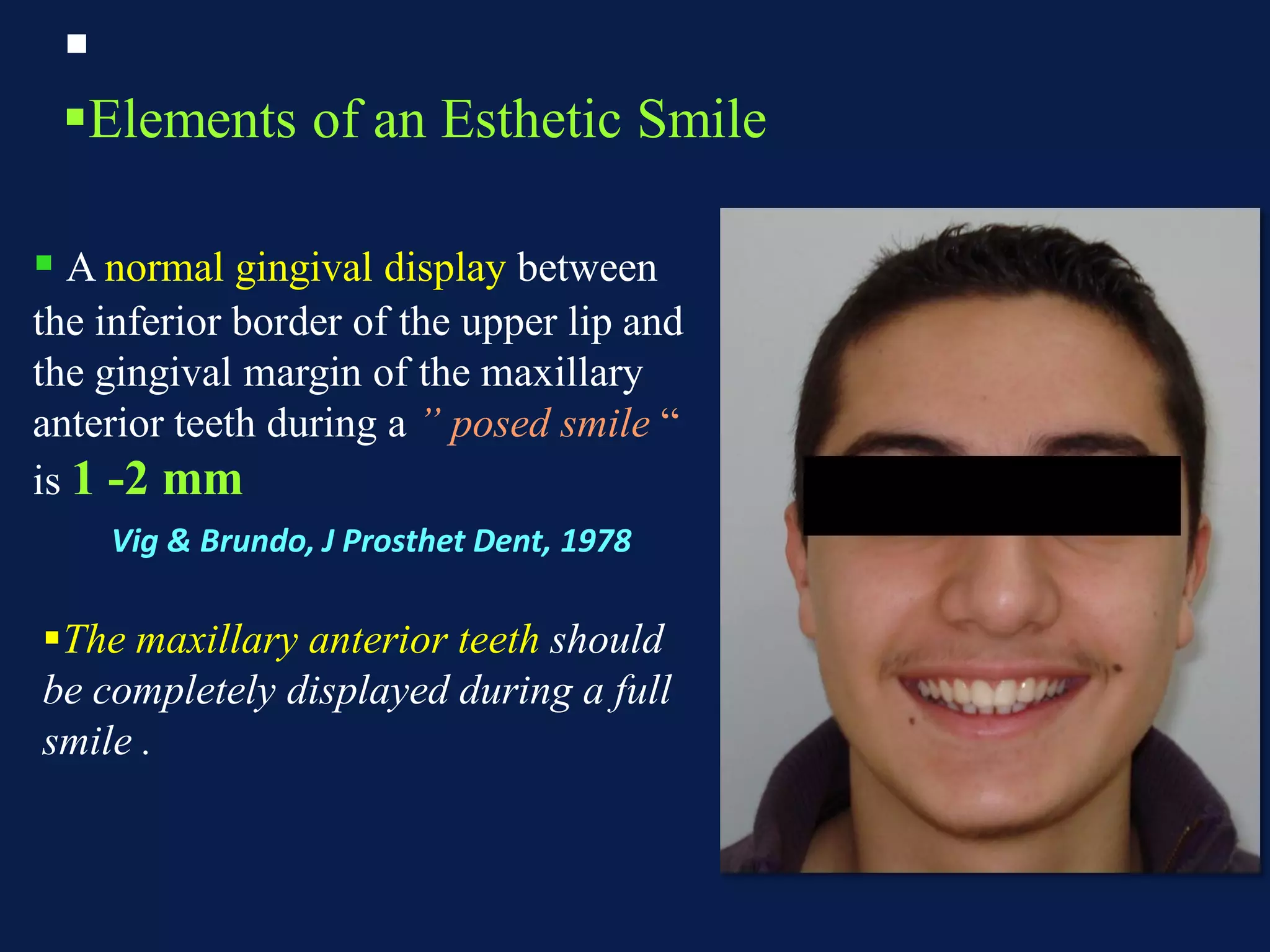 Diagnosis and treatment of gummy smile | PDF