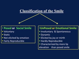 Diagnosis and treatment of gummy smile | PDF