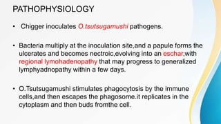 DIAGNOSIS AND TREATMENT OF SCRUB THYPUS | PPTX