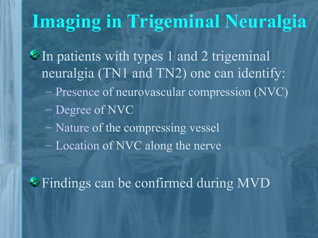 Diagnosis and Treatment of Trigeminal Neuralgia.ppt