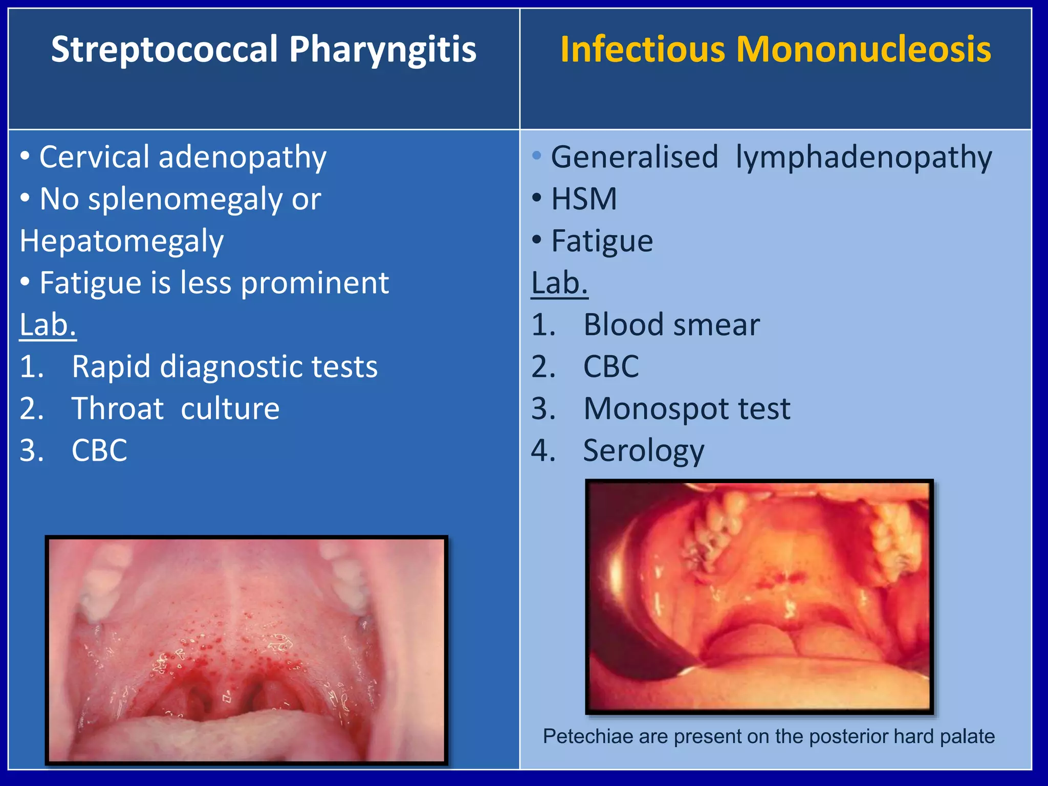 Diagnosis And Treatment Of Urti Ppt