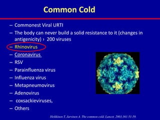 Diagnosis and treatment of URTI | PPTX