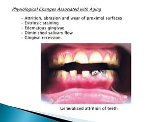 Diagnosis and treatment planing of conservative | PPTX