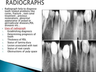 Diagnosis and treatment planing of conservative | PPTX