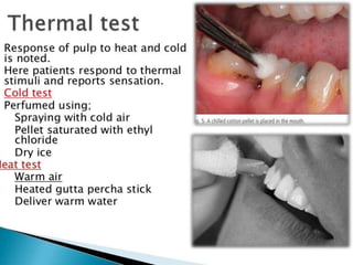 Diagnosis and treatment planing of conservative | PPTX