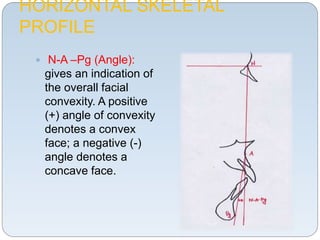 Diagnosis and treatment planning in Orthognathic Surgery | PPTX
