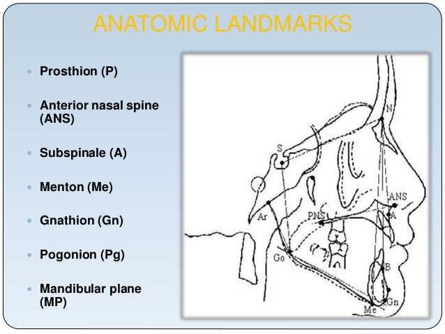 Diagnosis and treatment planning in Orthognathic Surgery