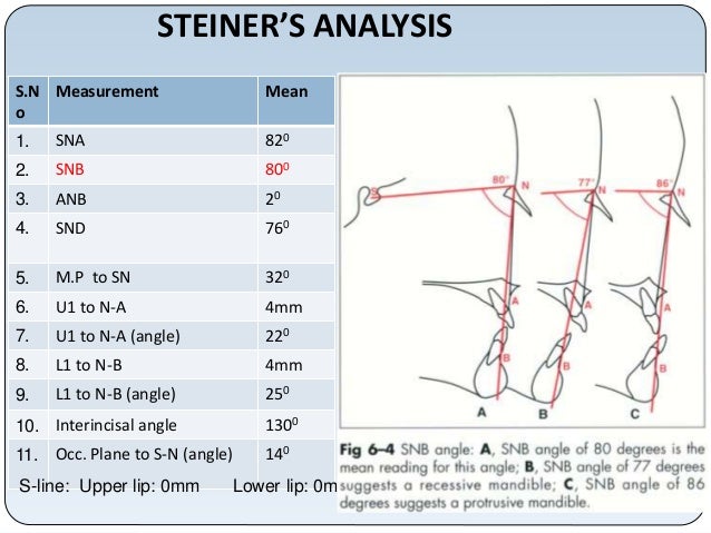 Diagnosis and treatment planning in Orthognathic Surgery