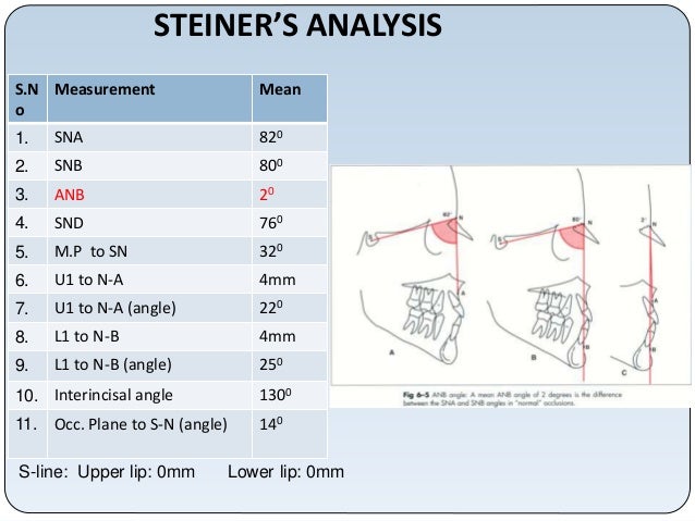 Diagnosis and treatment planning in Orthognathic Surgery