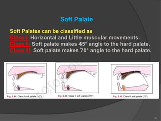 Diagnosis and treatment planning | PPTX
