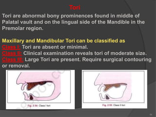 Diagnosis and treatment planning | PPT