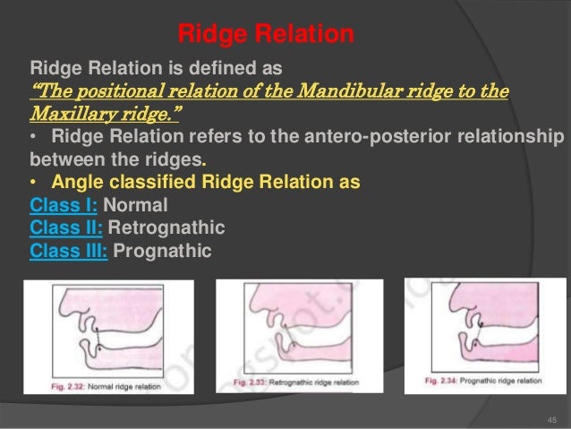 Diagnosis and treatment planning