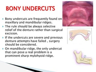 DIAGNOSIS AND TREATMENT PLANNING FOR COMPLETE DENTURES .pdf