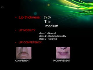 Diagnosis and treatment planning for complete dentures by dr brajendra ...