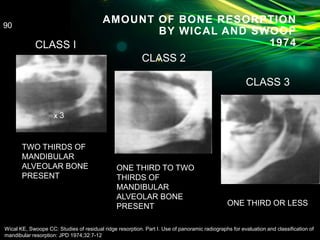 Diagnosis and treatment planning for complete dentures by dr brajendra ...