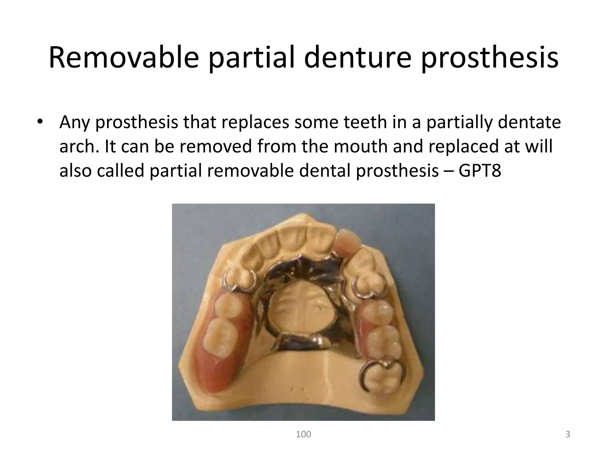 Diagnosis and treatment planning for removable partial dentures | PPTX