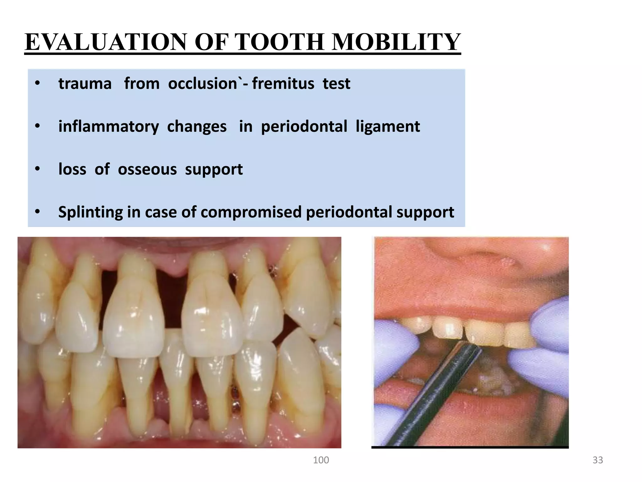 Diagnosis and treatment planning for removable partial dentures | PPTX