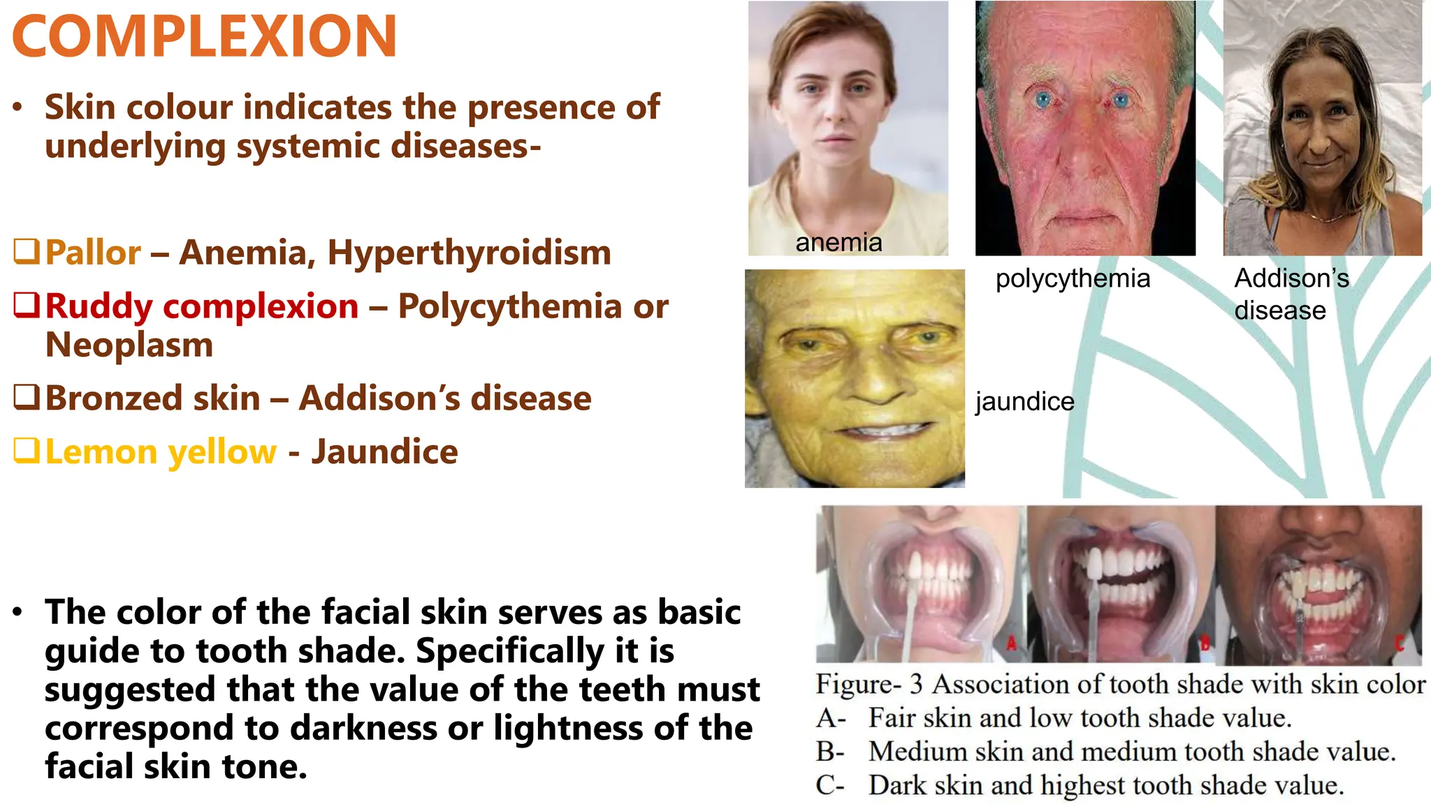 Diagnosis and treatment planning in complete denture.pptx