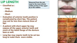 Diagnosis and treatment planning in complete denture.pptx