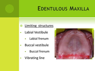 Diagnosis and treatment planning in complete dentures | PPTX