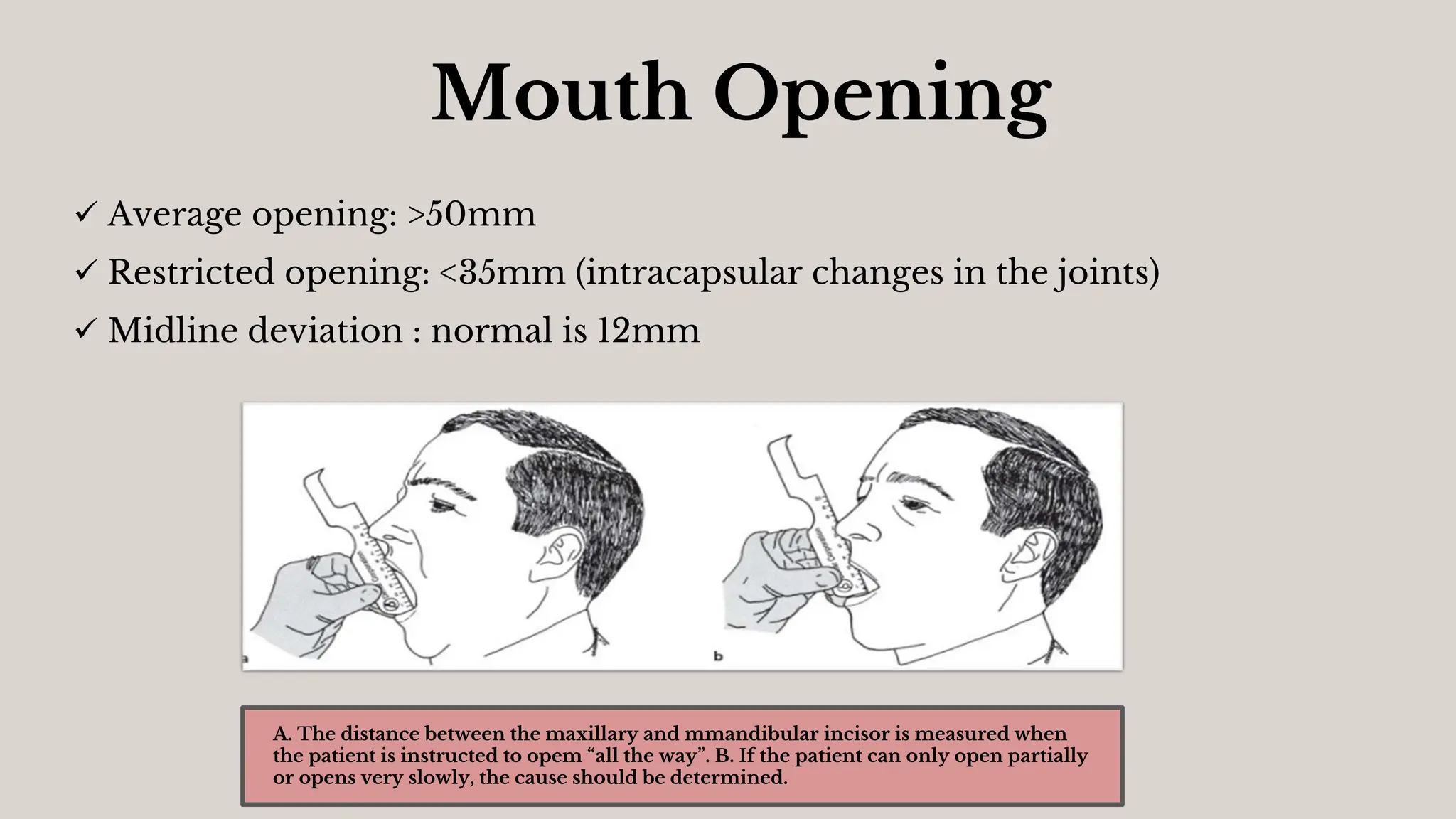 Diagnosis And Treatment Planning in Fixed Prosthodontics.pptx