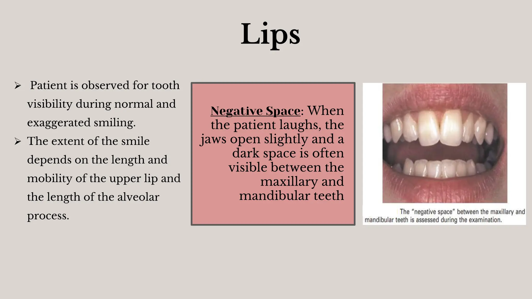 Diagnosis And Treatment Planning in Fixed Prosthodontics.pptx