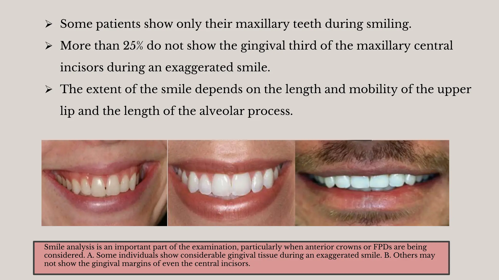 Diagnosis And Treatment Planning in Fixed Prosthodontics.pptx