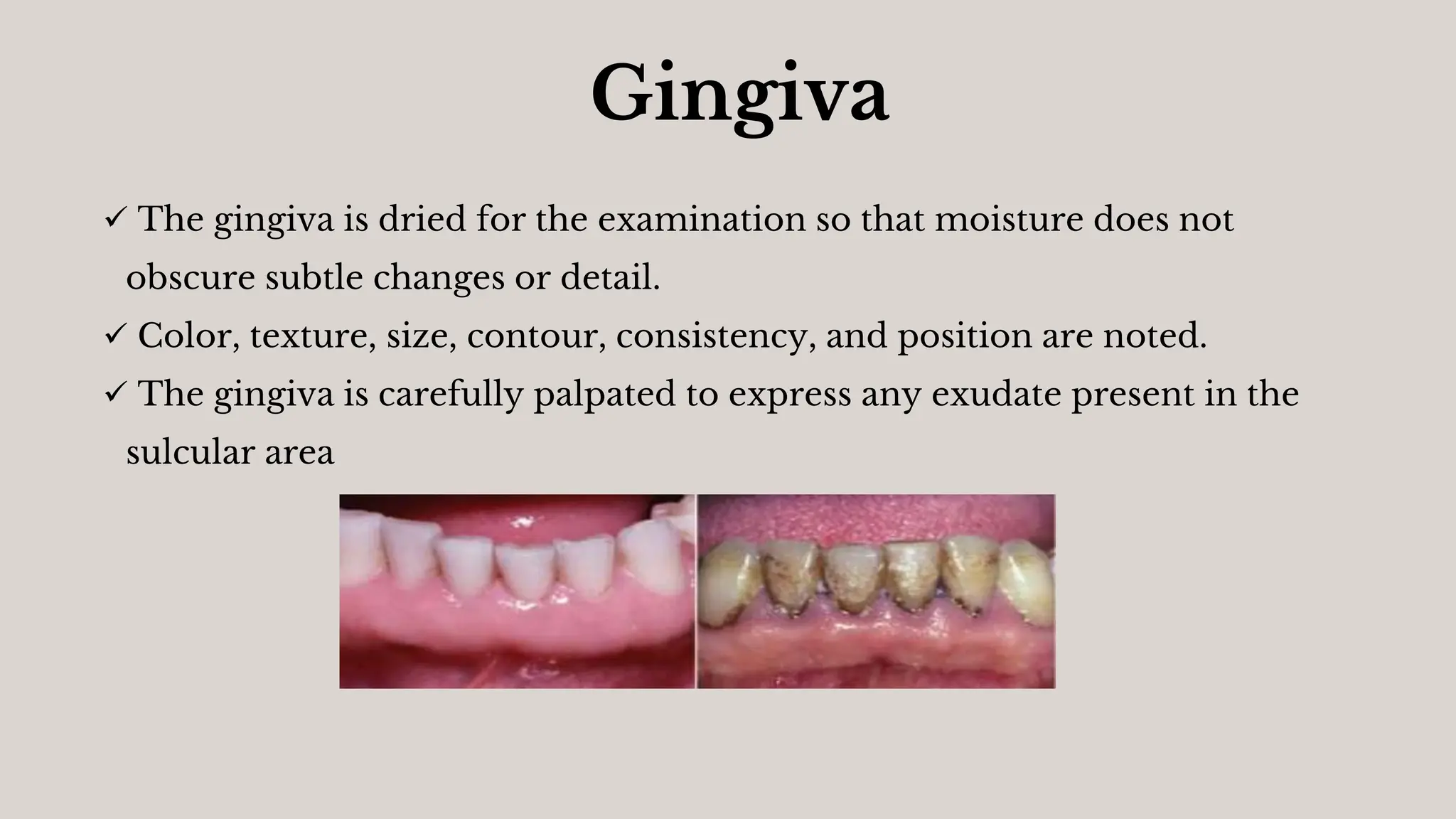 Diagnosis And Treatment Planning in Fixed Prosthodontics.pptx