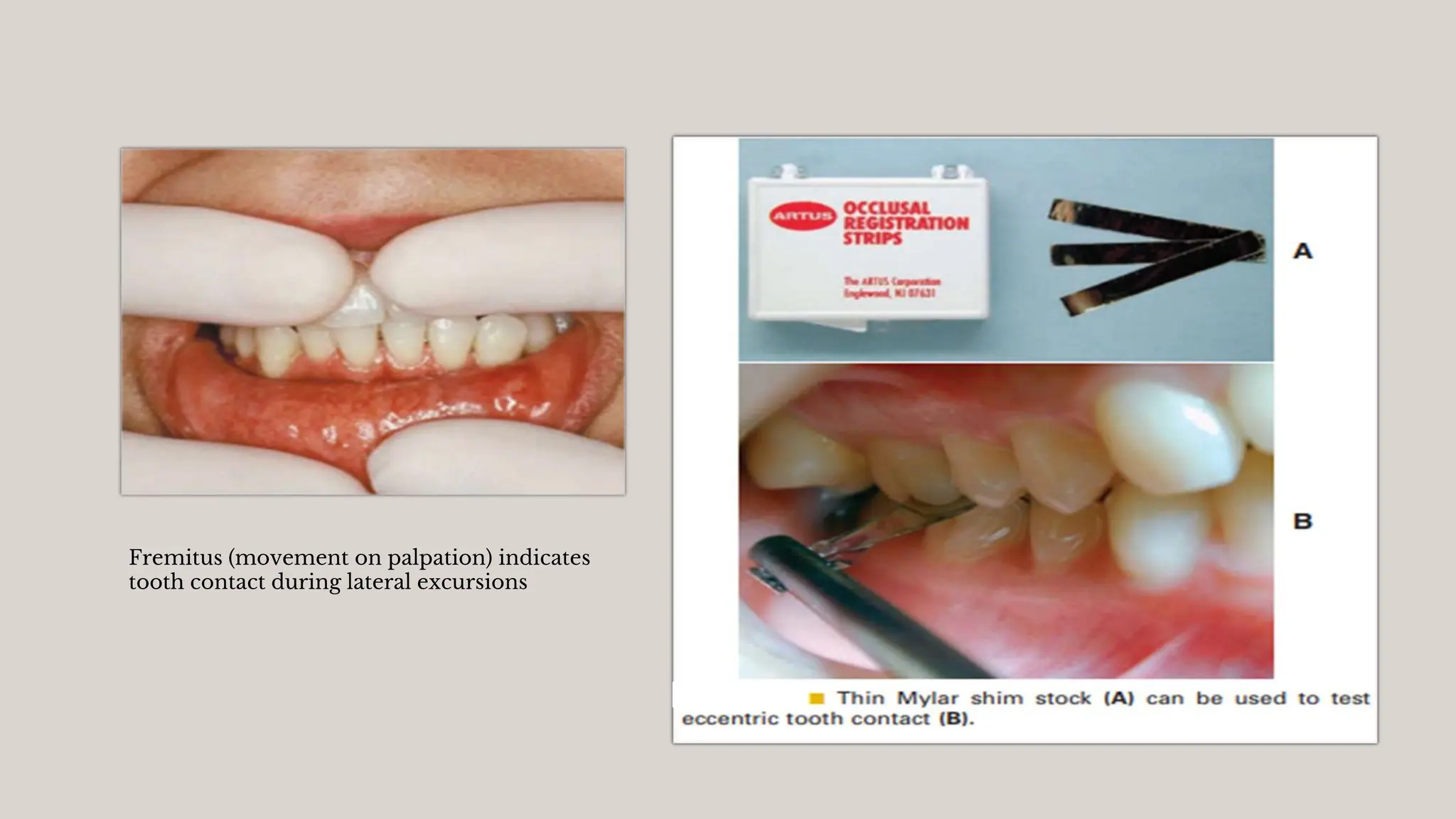 Diagnosis And Treatment Planning in Fixed Prosthodontics.pptx