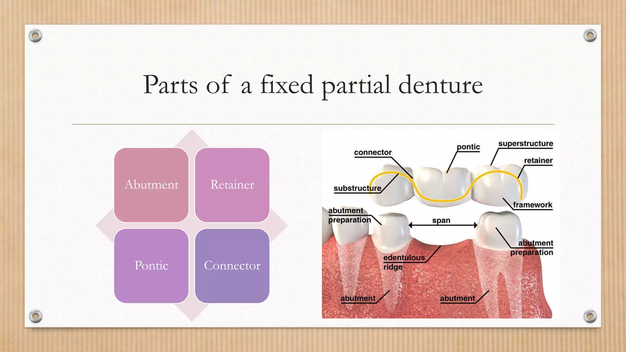 Diagnosis and treatment planning in fixed partial dentures | PPTX