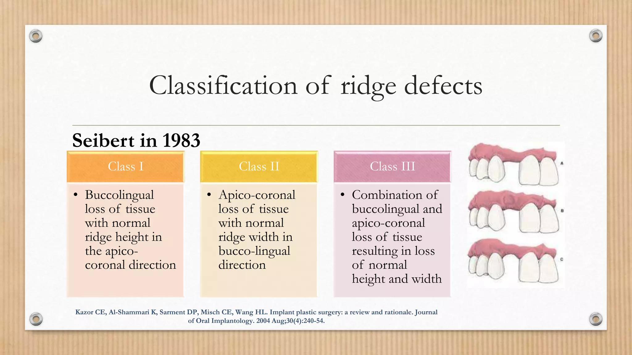 Diagnosis and treatment planning in fixed partial dentures | PPTX
