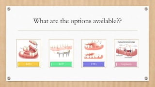 Diagnosis and treatment planning in fixed partial dentures | PPTX