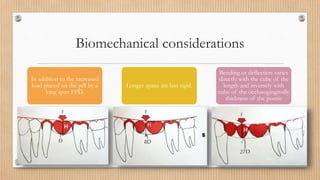 Diagnosis and treatment planning in fixed partial dentures | PPTX