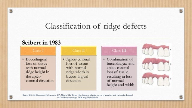 Diagnosis and treatment planning in fixed partial dentures