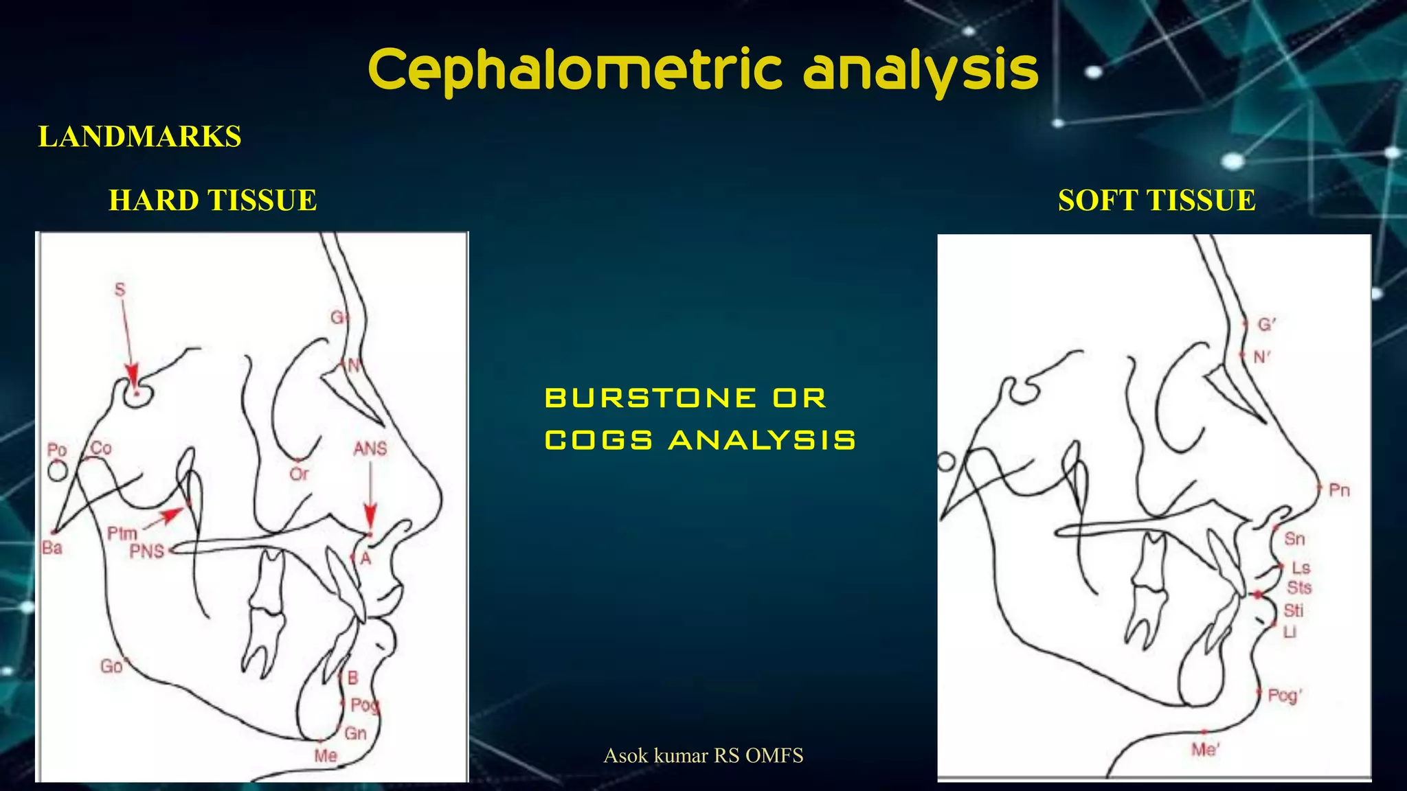 Diagnosis and treatment planning in orthognathic surgery | PDF