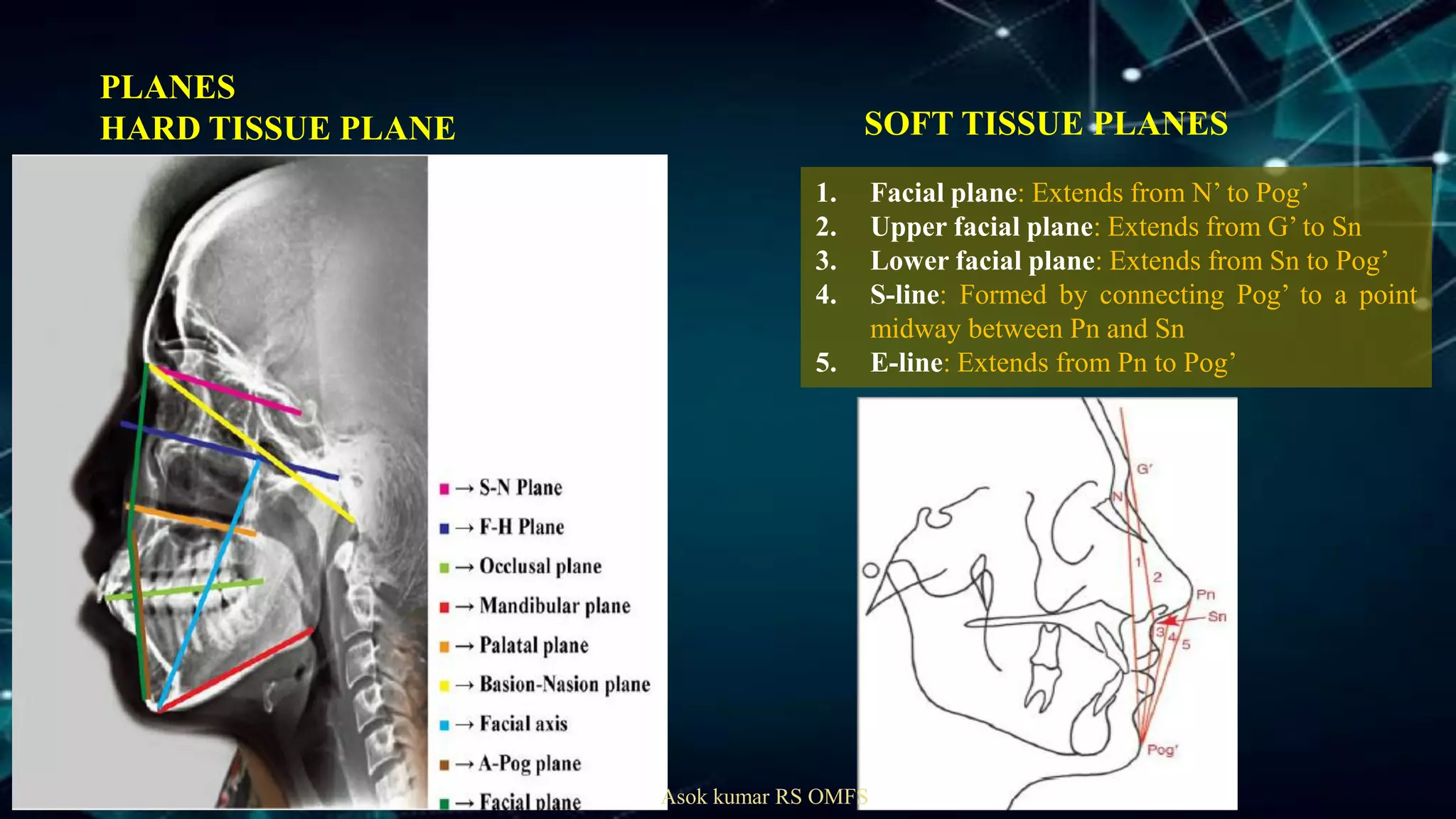 Diagnosis and treatment planning in orthognathic surgery | PDF