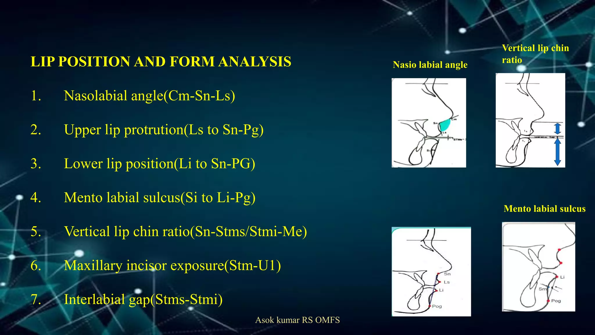 Diagnosis and treatment planning in orthognathic surgery | PDF