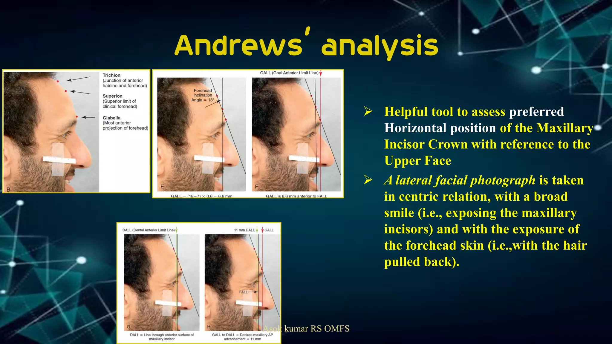 Diagnosis and treatment planning in orthognathic surgery | PDF