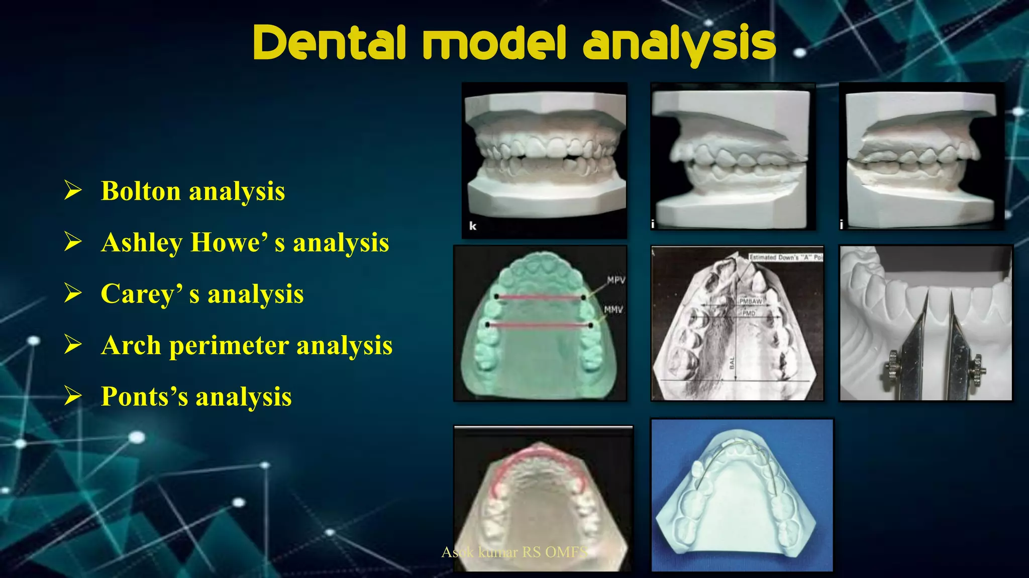 Diagnosis and treatment planning in orthognathic surgery | PDF