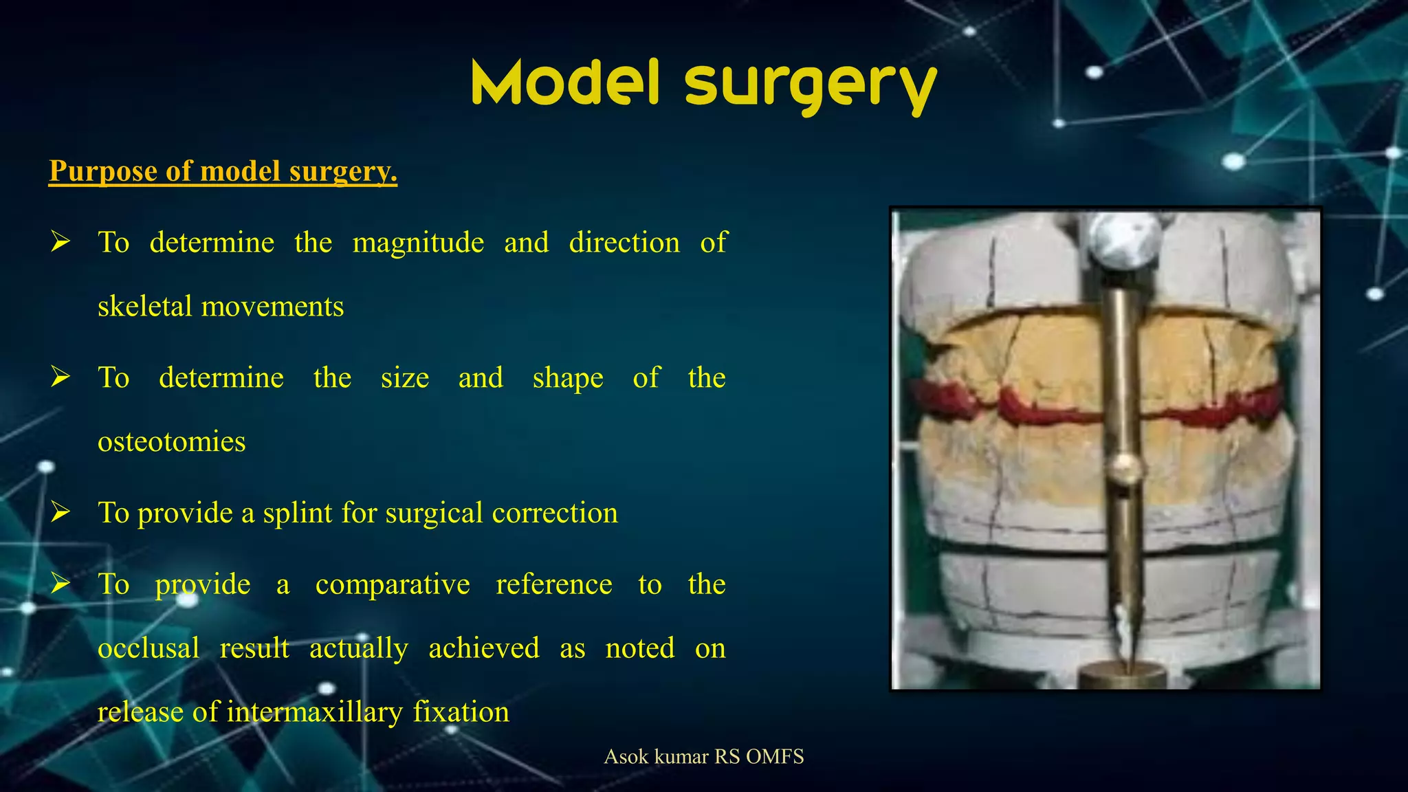 Diagnosis and treatment planning in orthognathic surgery | PDF