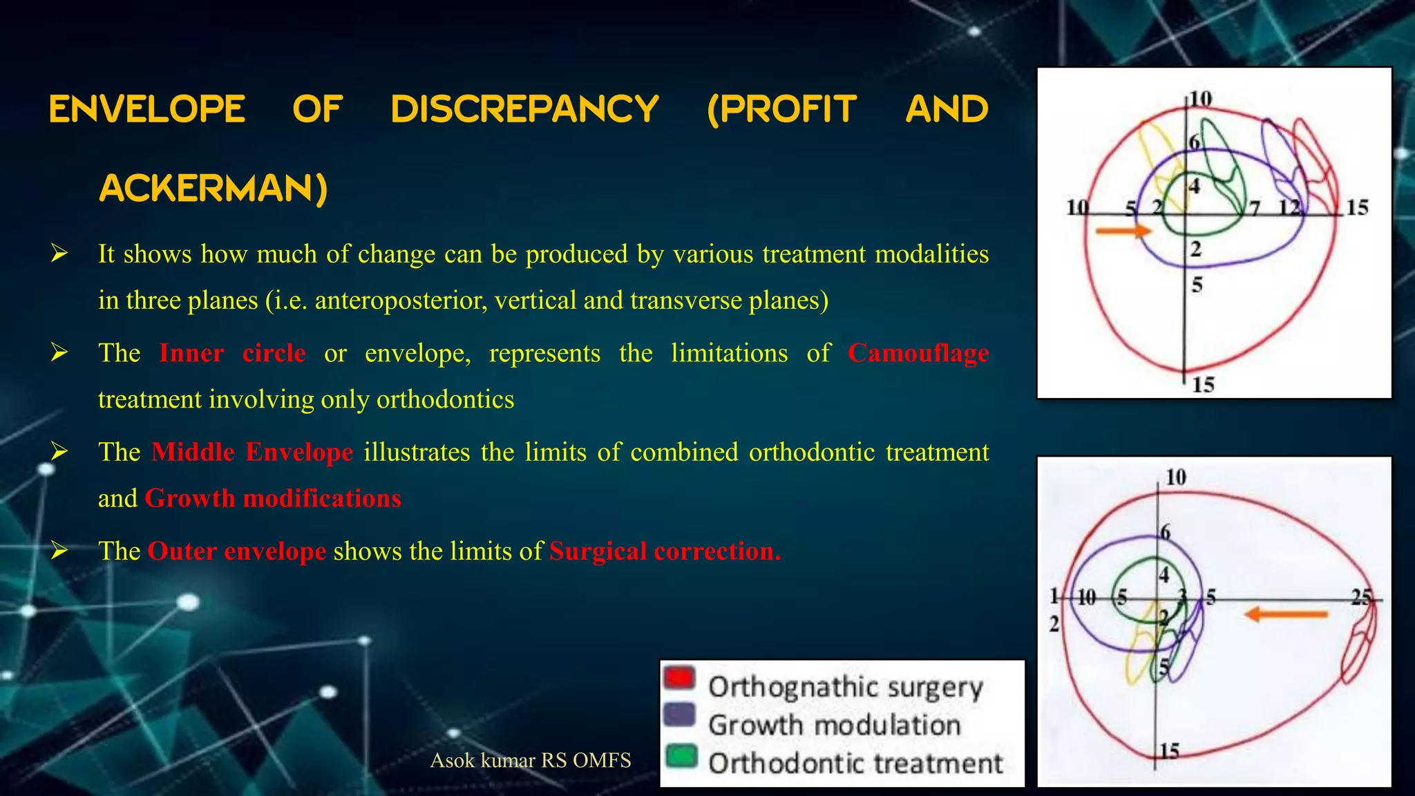 Diagnosis and treatment planning in orthognathic surgery | PDF