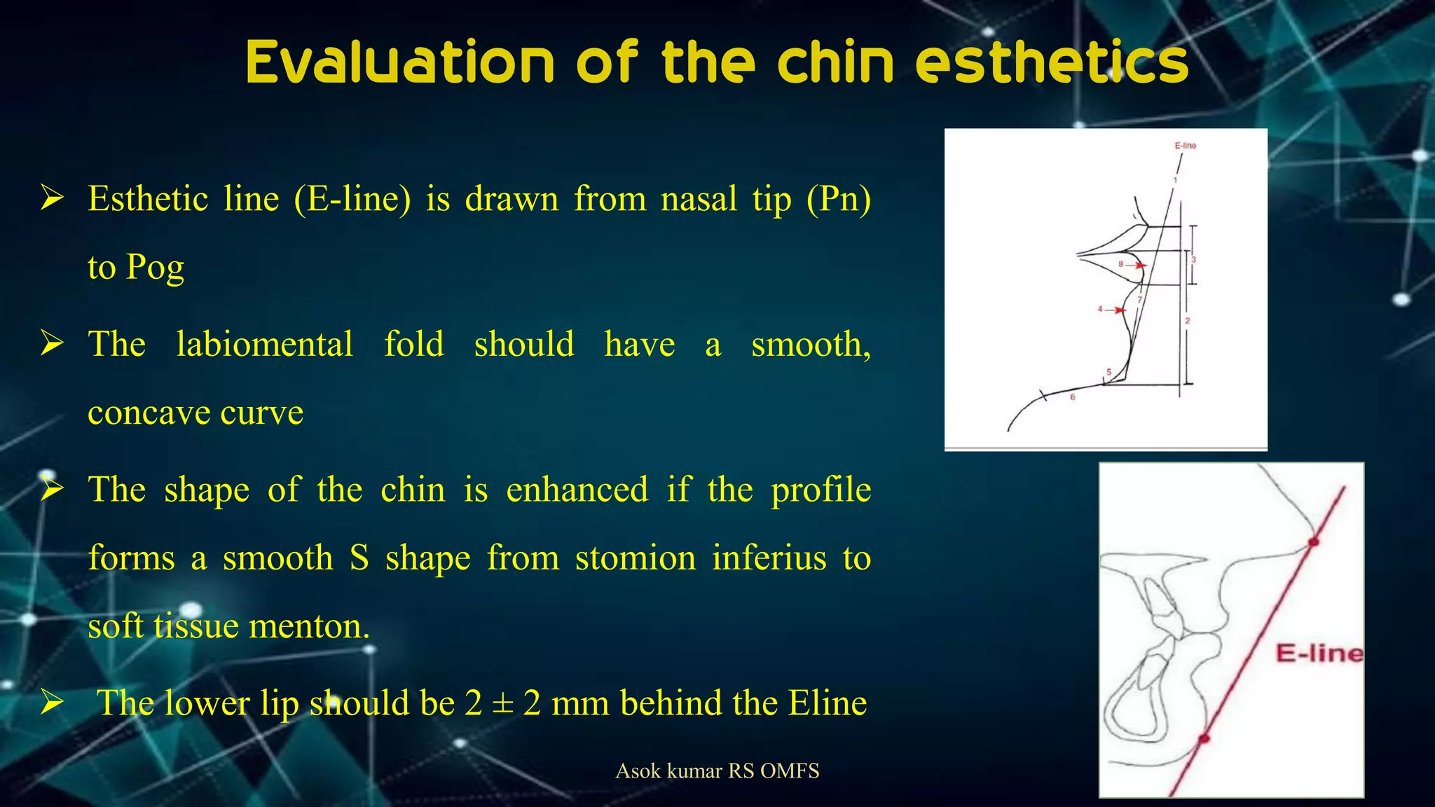 Diagnosis and treatment planning in orthognathic surgery | PDF